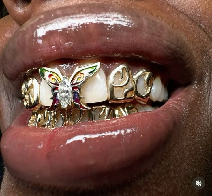Grillz 101: From Street Culture to Fashion-Forward — Strike Magazines
