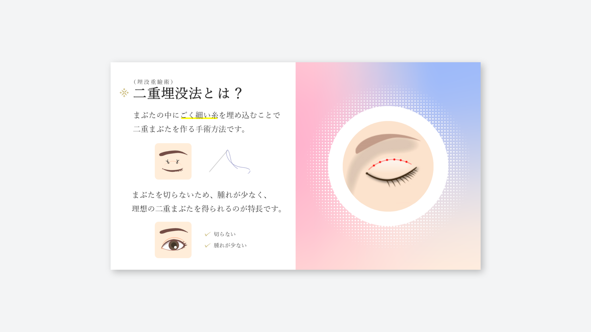 二重埋没法 | 美容クリニック | 患者向け説明資料 | パワーポイント資料作成 | PHAINO DESIGN — PHAINO DESIGN