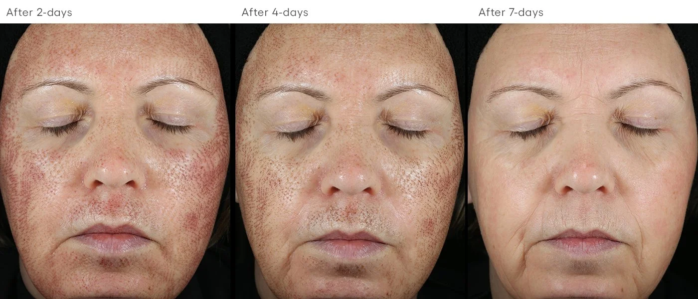 ( plated )™ Skin Science Products — Rion Aesthetics