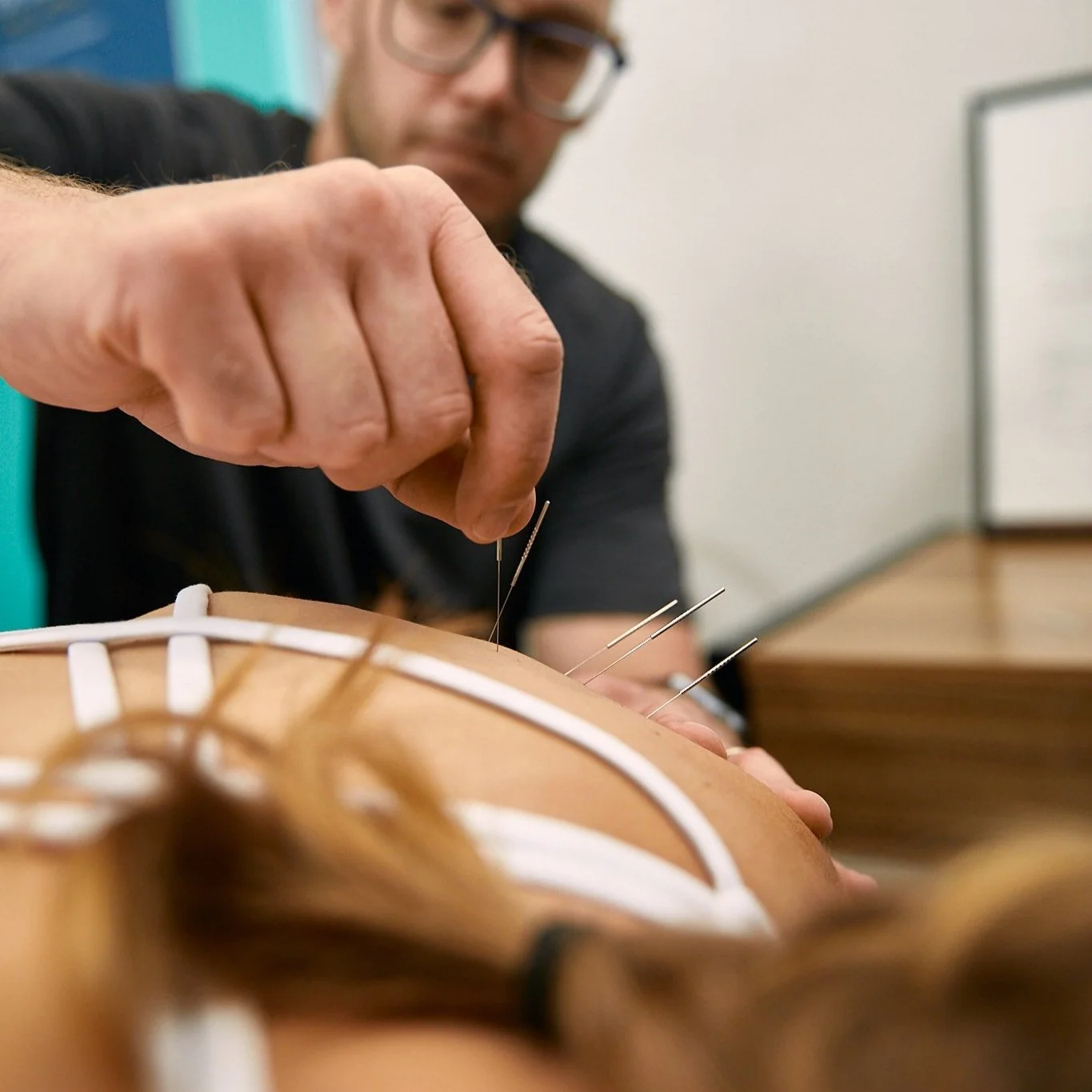Everything you need to know about Dry Needling | Portside Sports ...