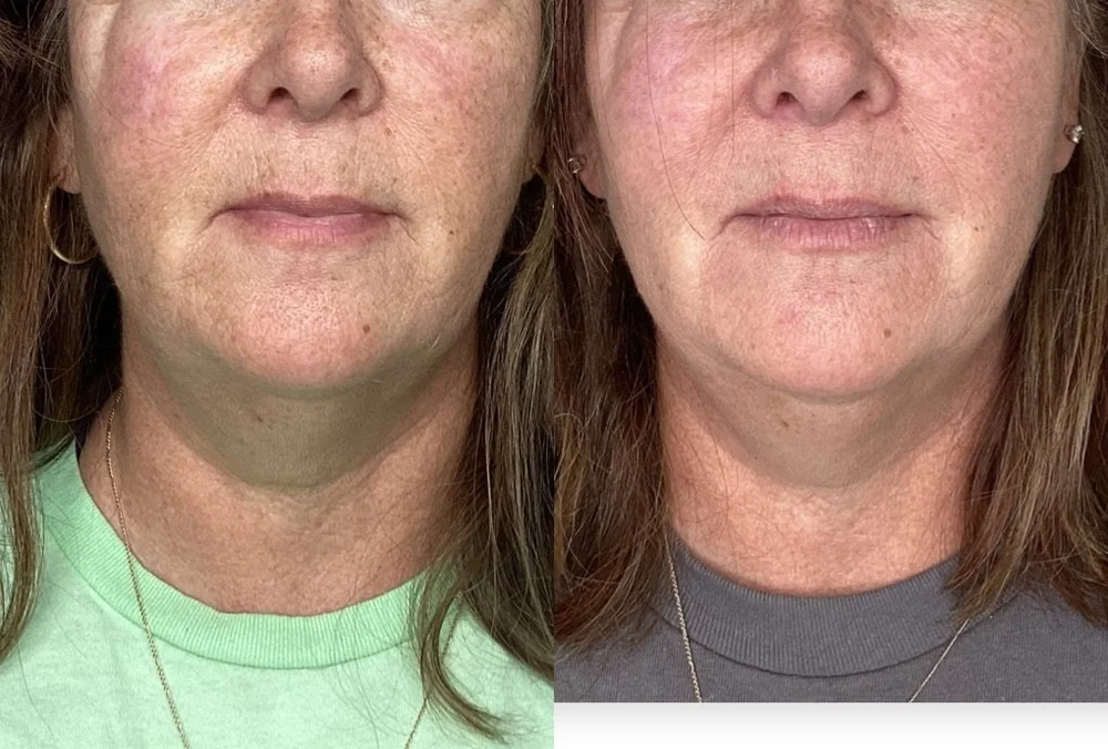 Carroll Cosmetic Club