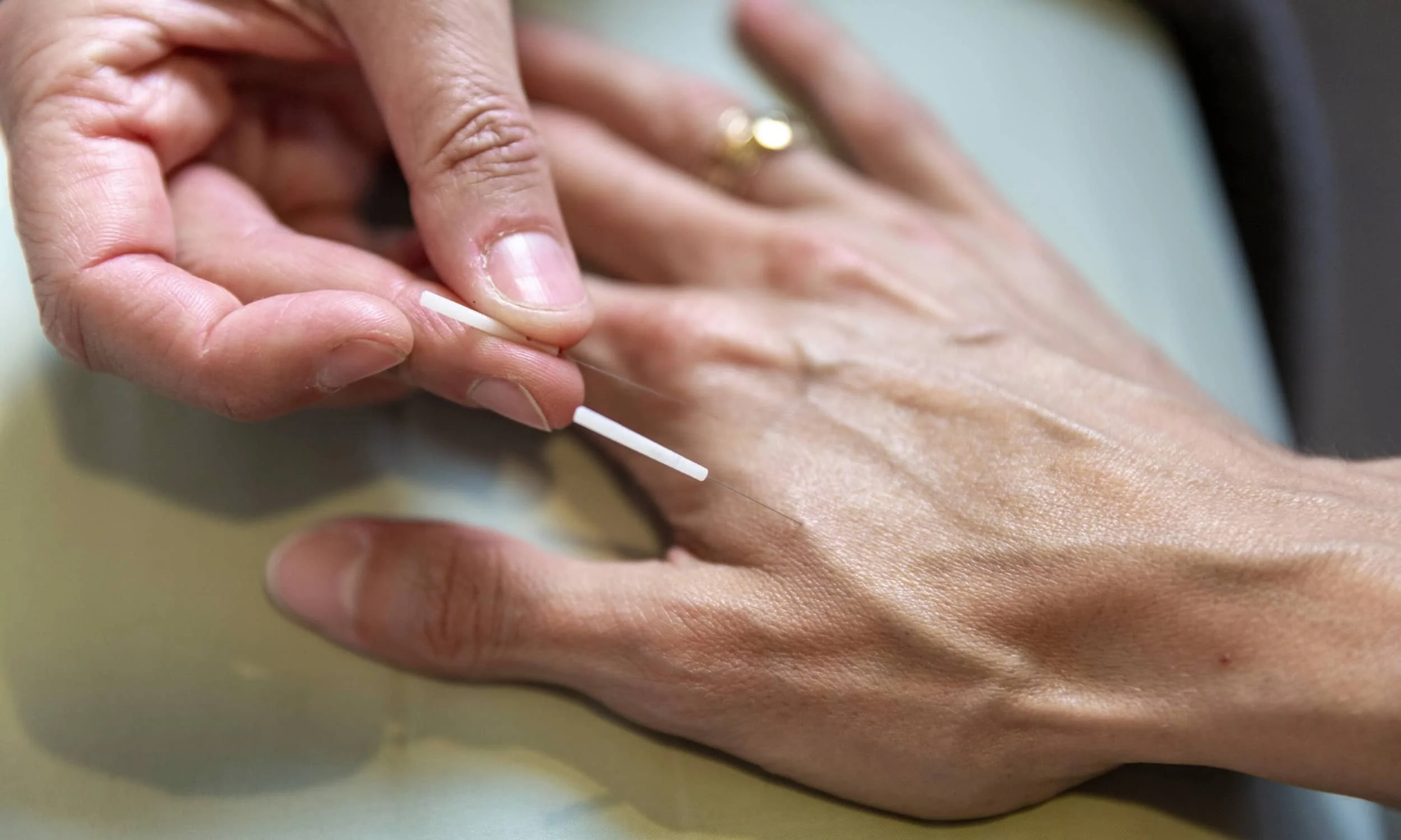 Integrative Acupuncture & Chinese Medicine Clinic Auckland NZ