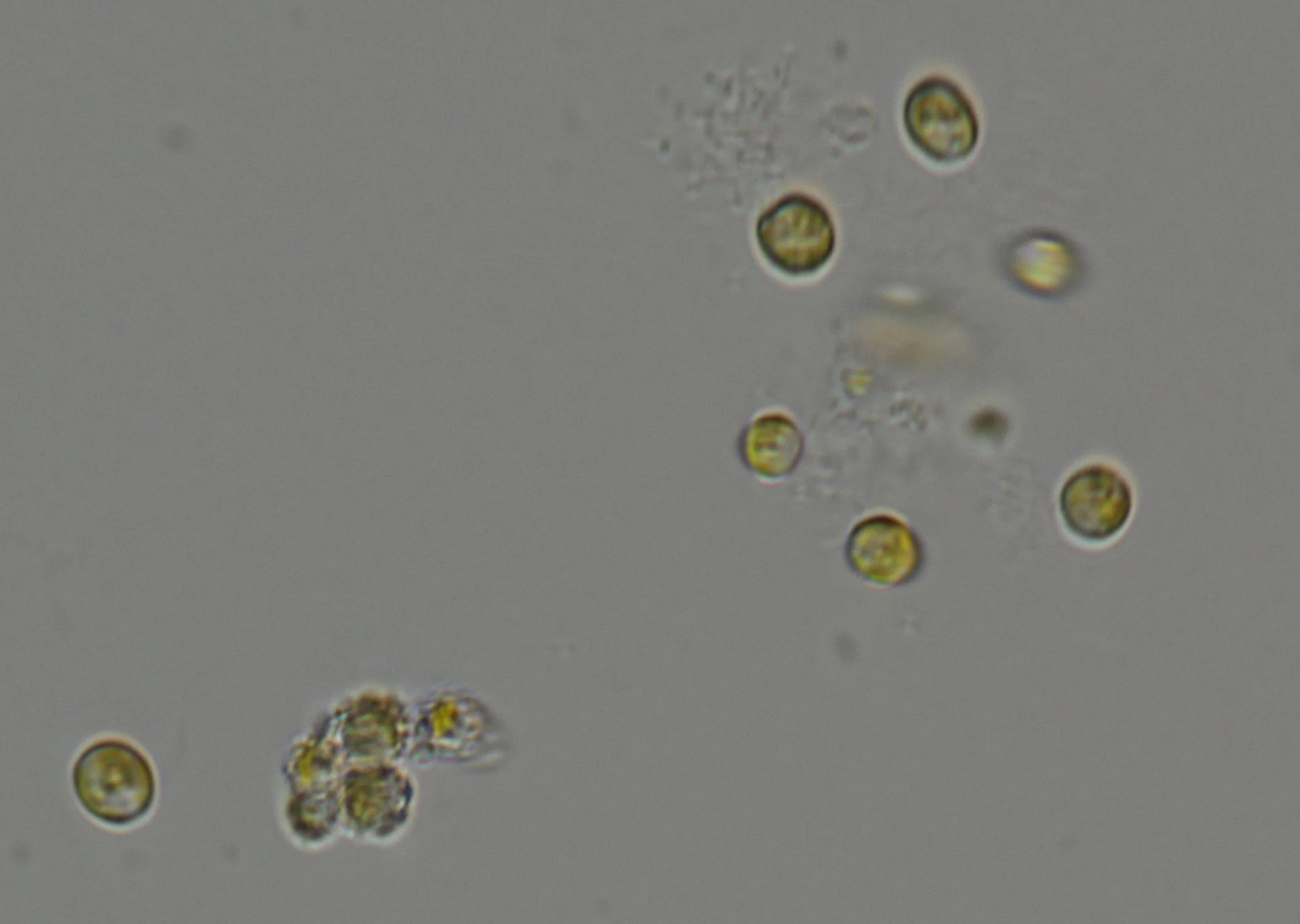 Algal-bacterial pathogenesis — The Case Lab