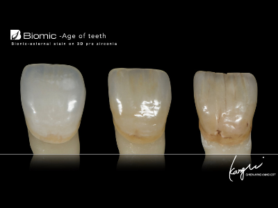 Aidite Biomic Stain & Glaze Aesthetic Kit — Chairside Solutions