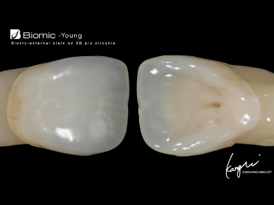 Aidite Biomic Stain & Glaze Aesthetic Kit — Chairside Solutions