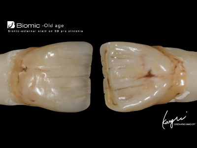 Aidite Biomic Stain & Glaze Aesthetic Kit — Chairside Solutions