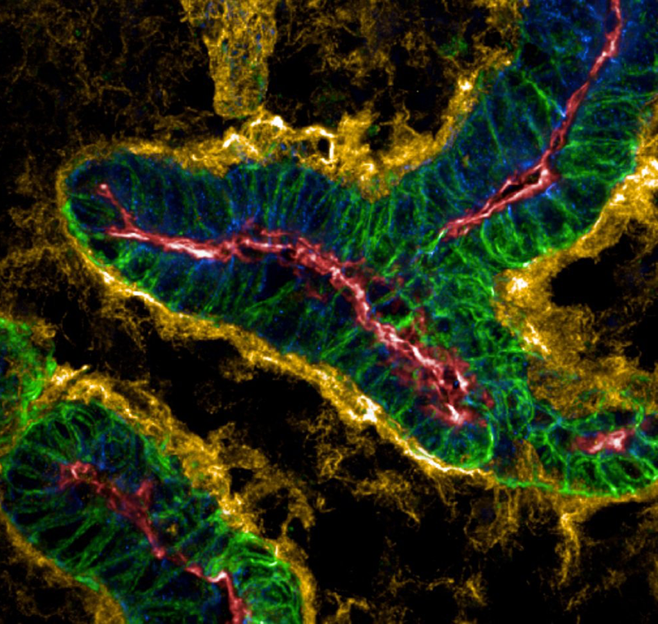 Research — Greka Lab