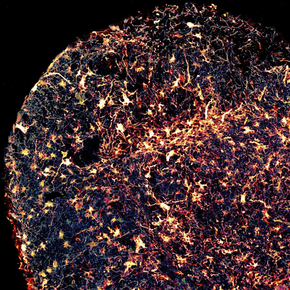 General 2 — Andersen Lab