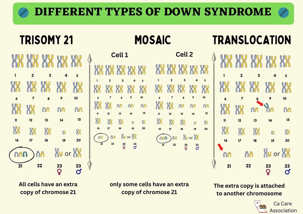 A Caregiver's Guide to Down Syndrome — Ca Care Association