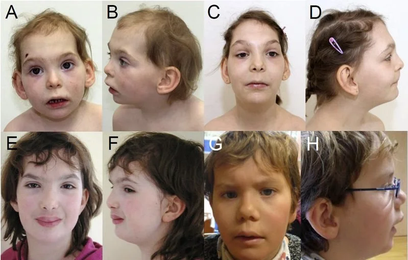 About 4 — BFLS Inc.