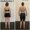 Fascia | The Hidden Web for Movement, Posture & Health — RootForce