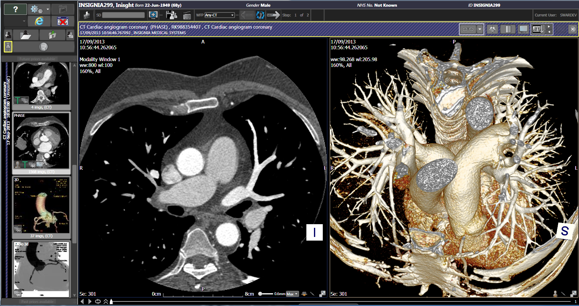 Breast PACS — Insignia Medical Systems