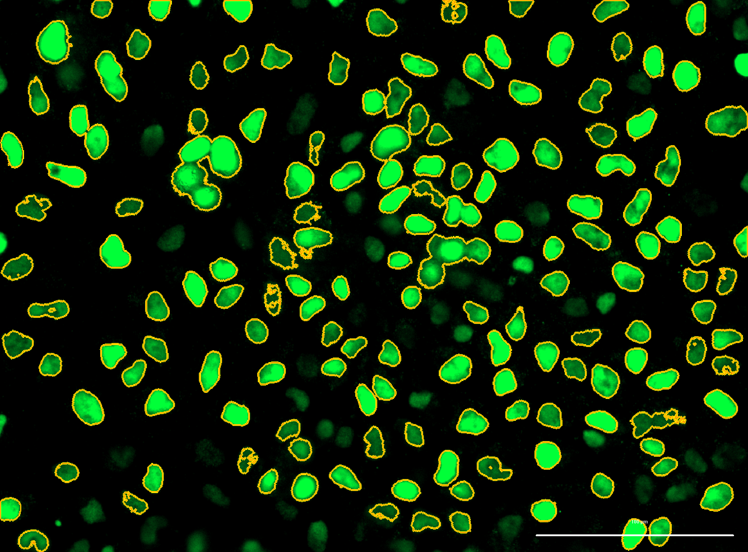 Advanced human iPSC cell models