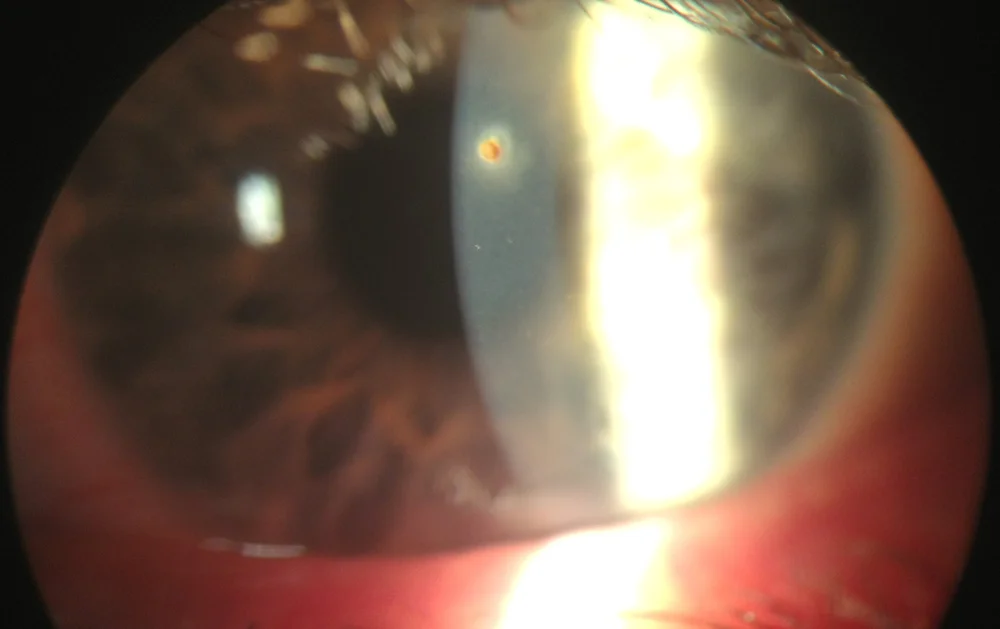 Services — Cheyenne Vision Clinic