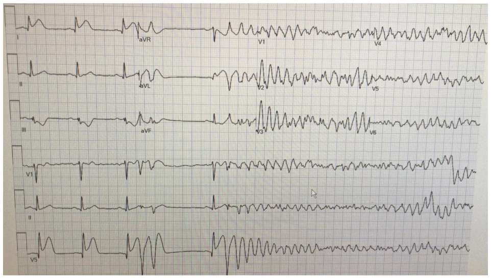 An ECG: a case for rapid access to ECG for diagnosis — Manitoba ACS Network