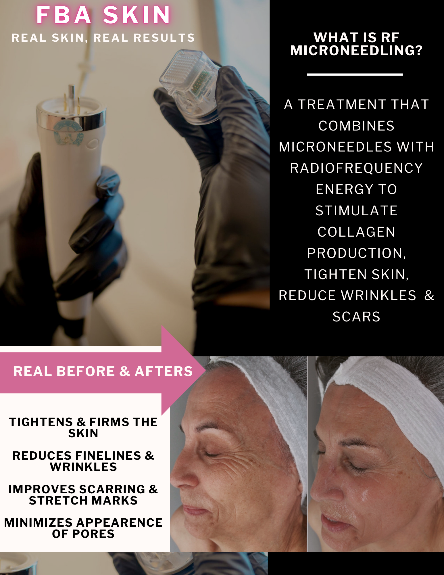 FBA Skin (Foreverbyash)