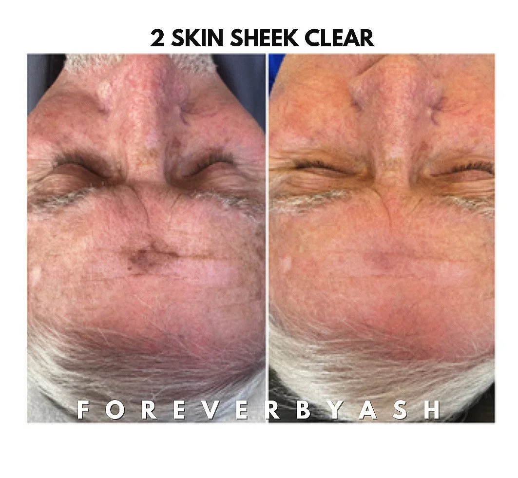 Skin Sheek Clear — FBA Skin (Foreverbyash)