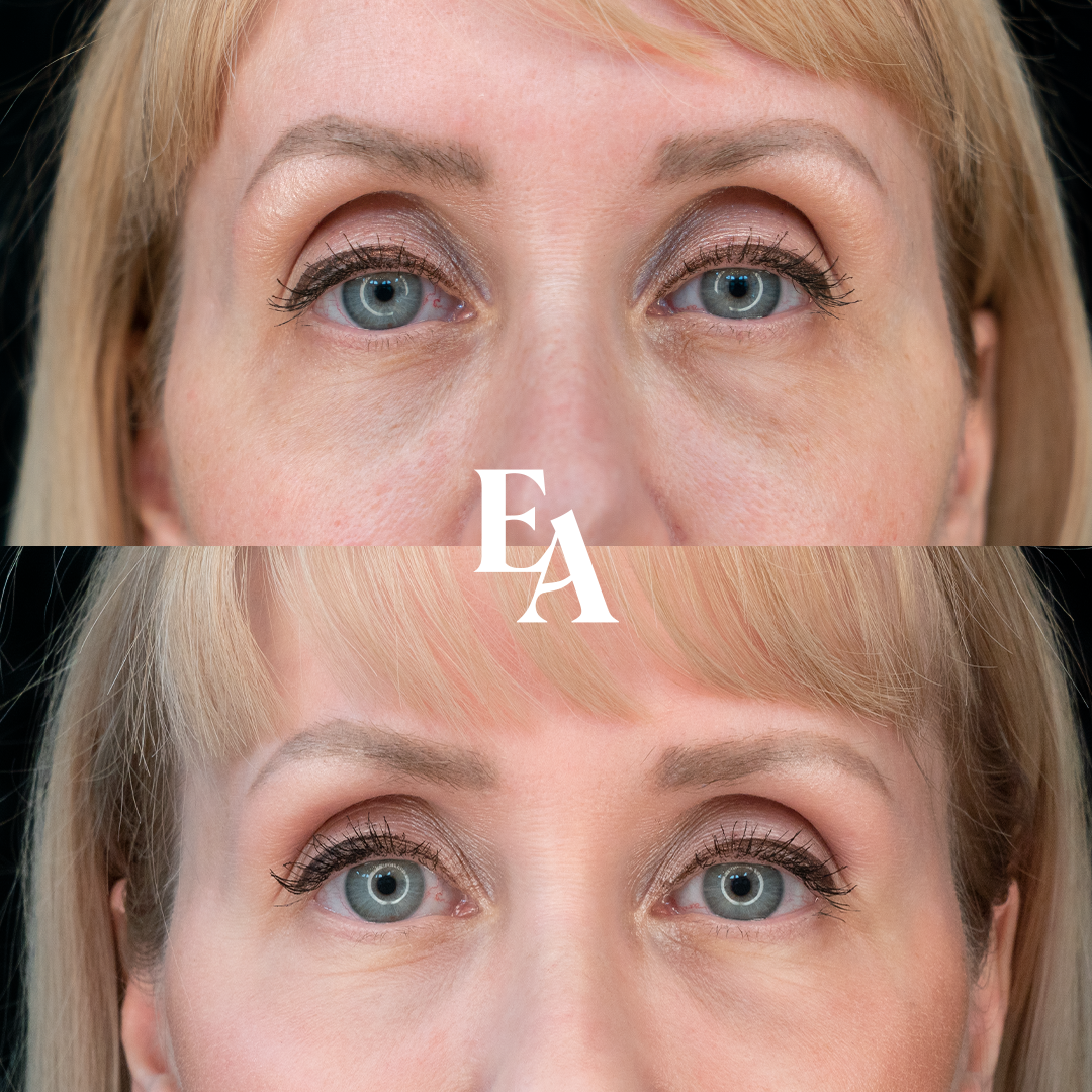 Venezia Eye Lift in Edmonton and St. Albert — External Affairs