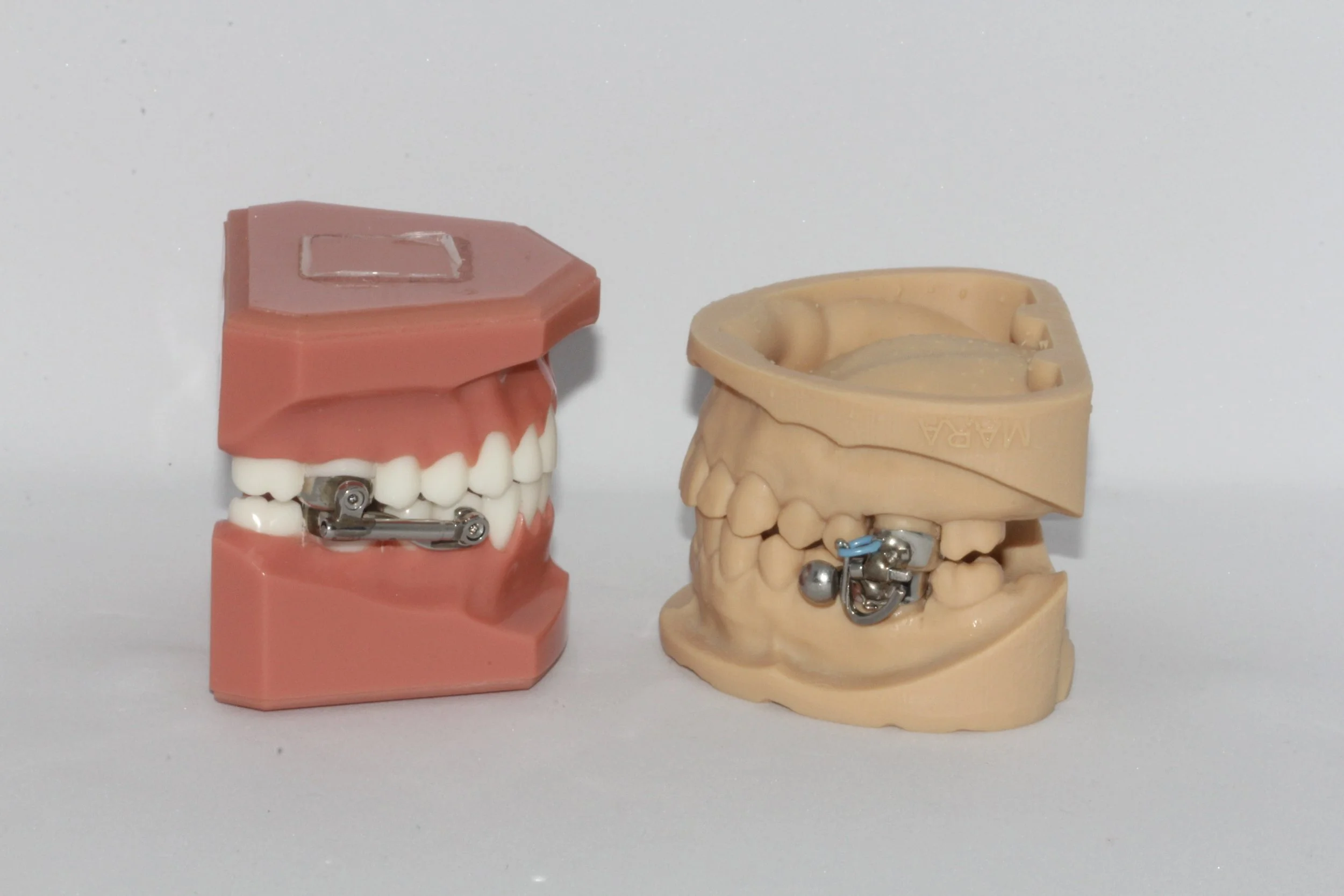 Appliances — A Point Dental Lab