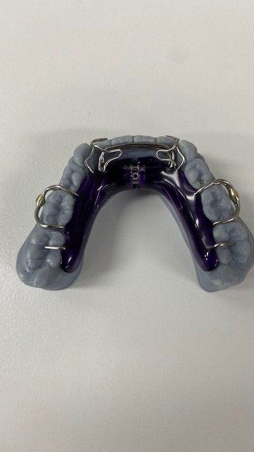 Appliances — A Point Dental Lab