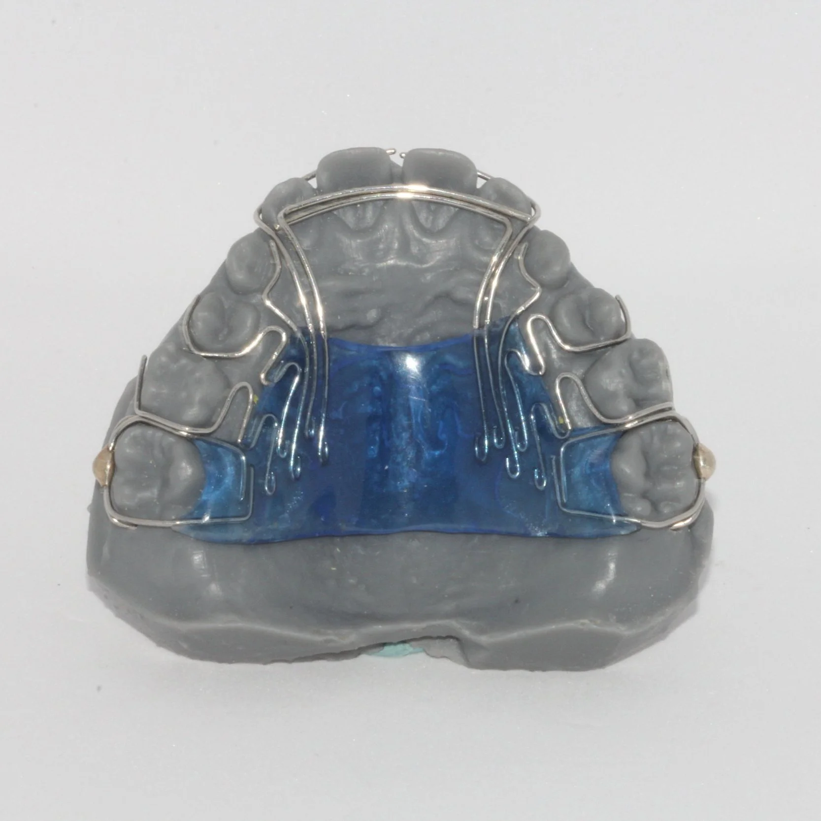 Appliances — A Point Dental Lab