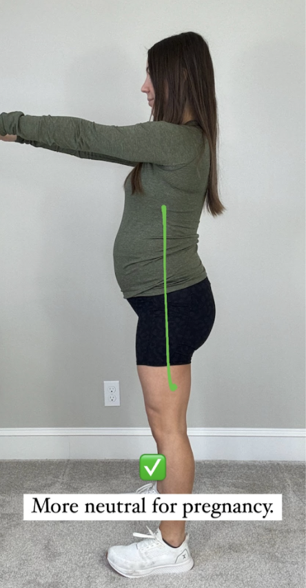Sciatica and Low Back Pain in Pregnancy — Doc Lizzie DPT