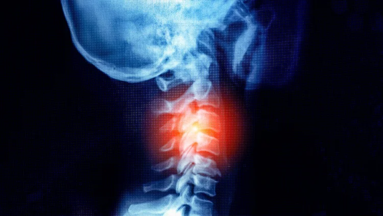 Real Near Death Experience Stories - NDE
