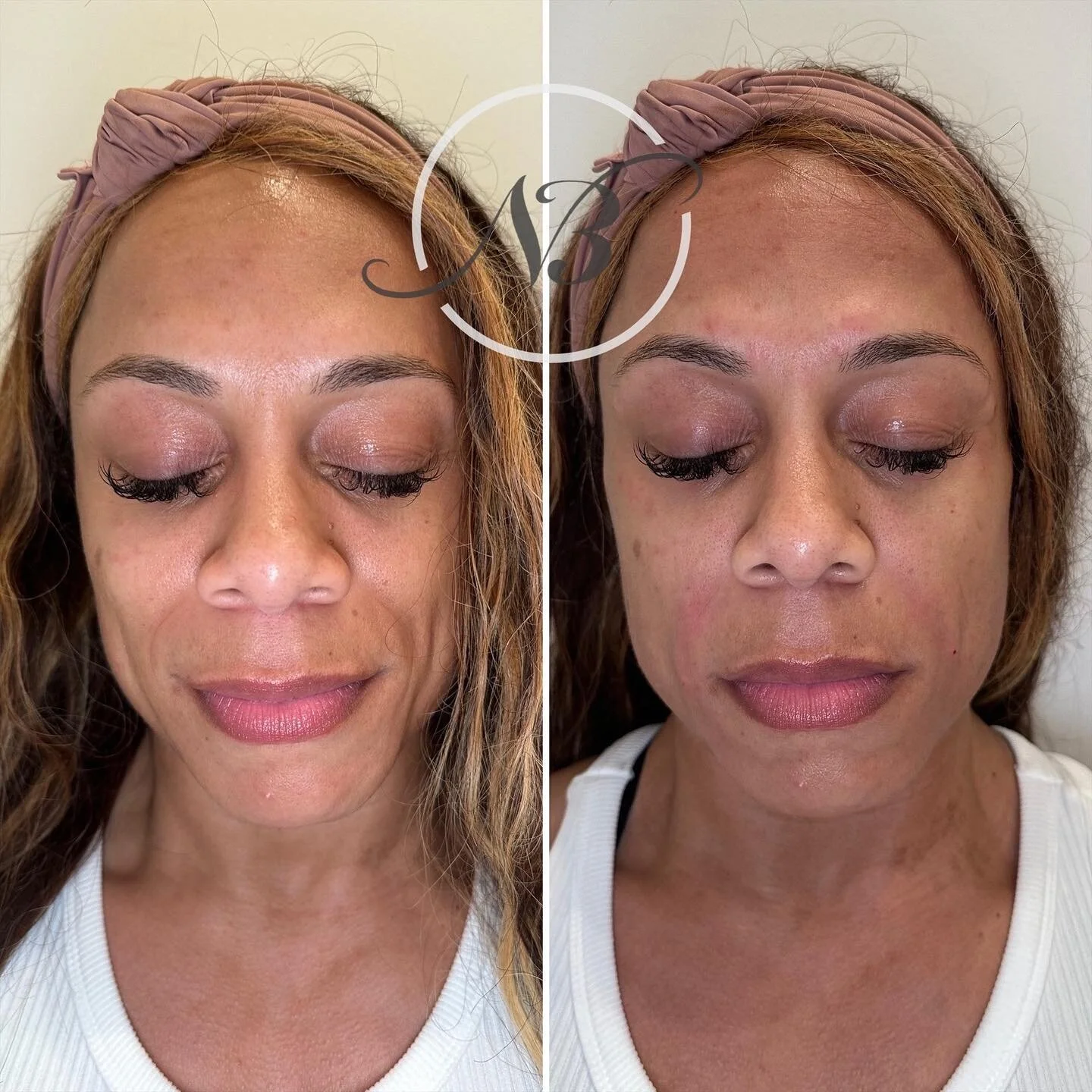 NuBella MedSpa