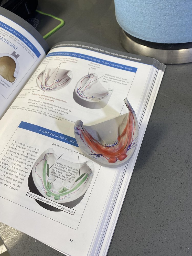 Retromylohyoid Fold