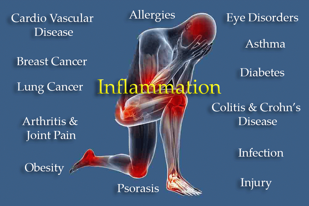 Chronic Inflammation: Statistics and How to Combat It — MyEMSHealth