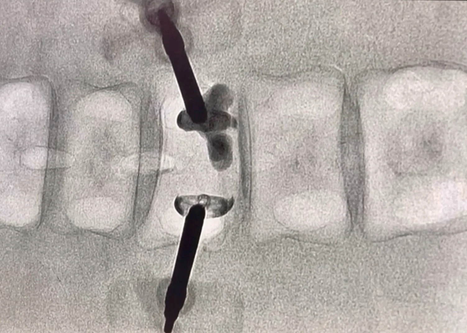 NEUROSURGERY PHANTOMS — VIOMERSE