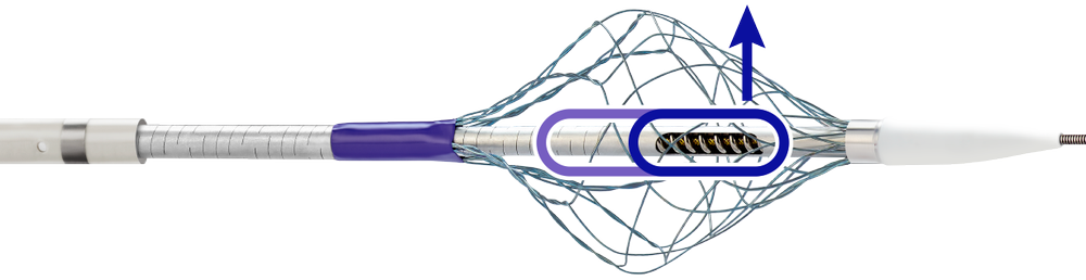 Pounce™ Venous Thrombectomy System — Pounce™ Venous Thrombectomy System