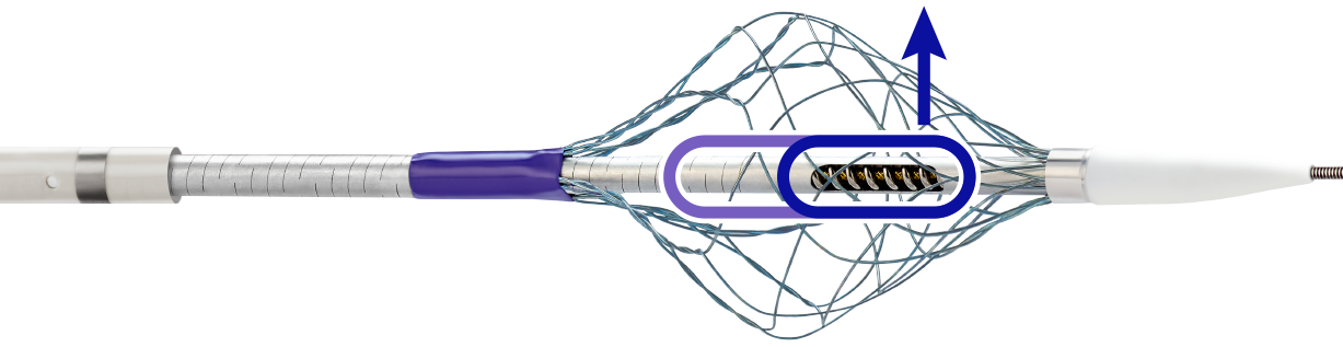 Pounce™ Venous Thrombectomy System — Pounce™ Venous Thrombectomy System