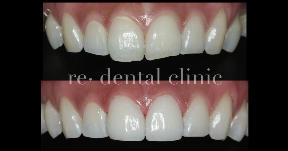 Cosmetic and General Dentistry in Auckland | re·dental clinic