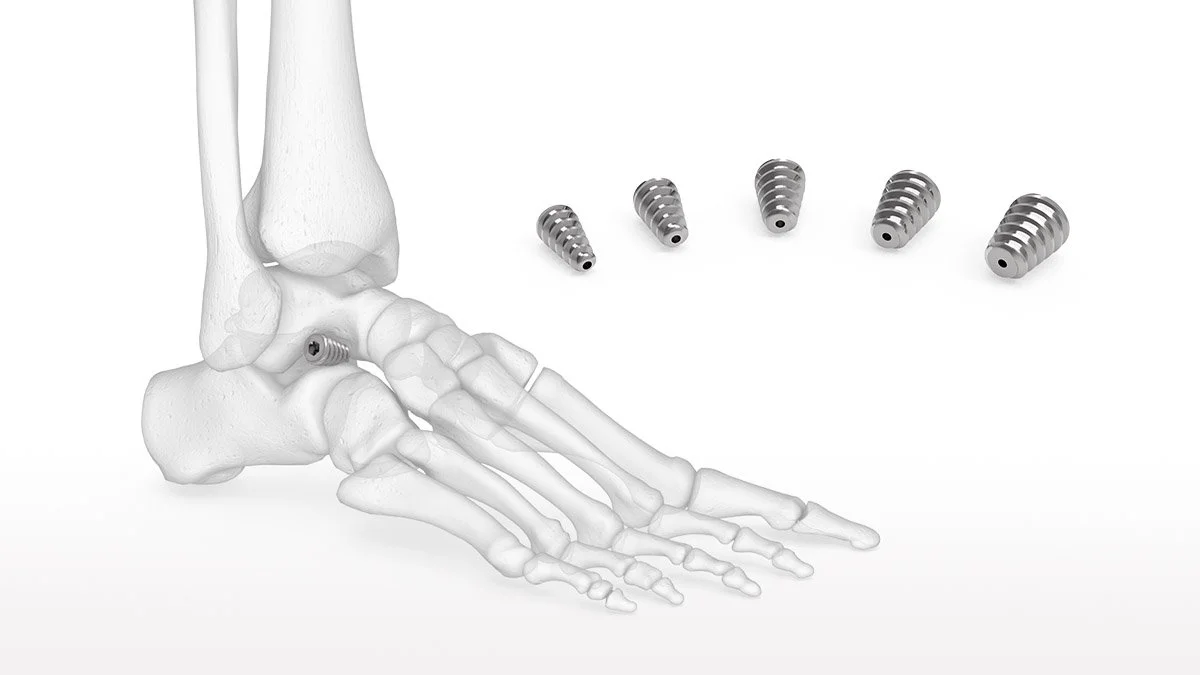 LIST OF MOST COMMON FOOT ANKLE LEG SURGERY PROCEDURES