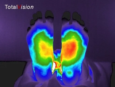 Full Body Thermography Study, Nashville, TN — Sozo Thermography