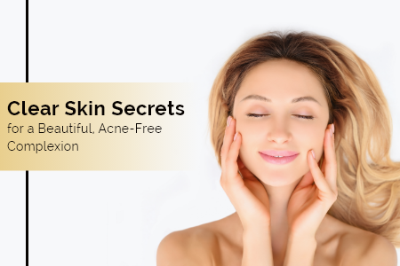 Tackling Acne: Clear Skin Secrets | Get an Acne-Free Complexion — You ...