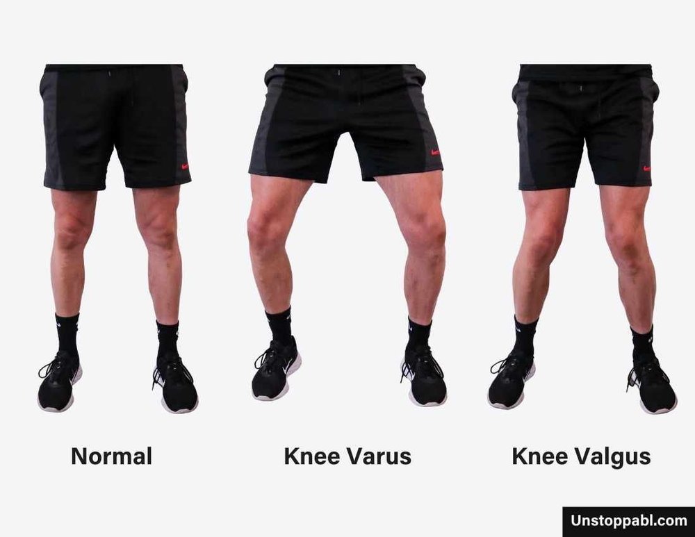 How To Prevent Knee Pain When Running [15 Ways] — Unstoppabl