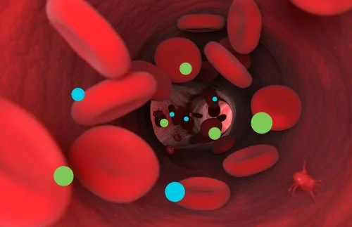 IsoPSA® TESTING | Cleveland Diagnostics — Cleveland Diagnostics