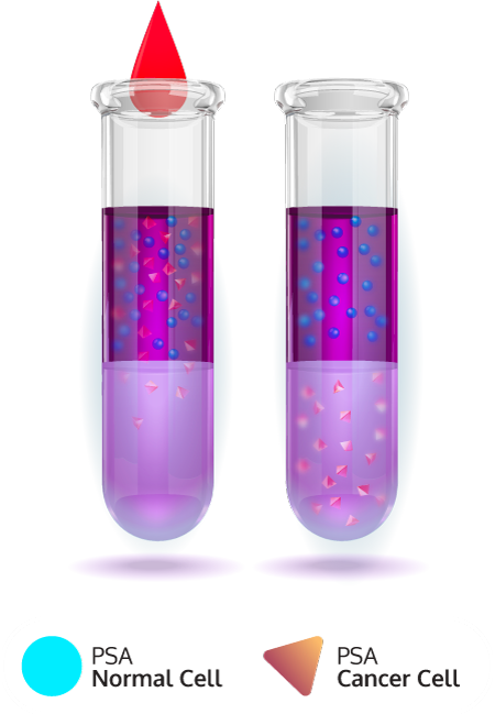 IsoPSA Testing — Cleveland Diagnostics