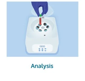 IsoPSA® Experience — Cleveland Diagnostics — Cleveland Diagnostics