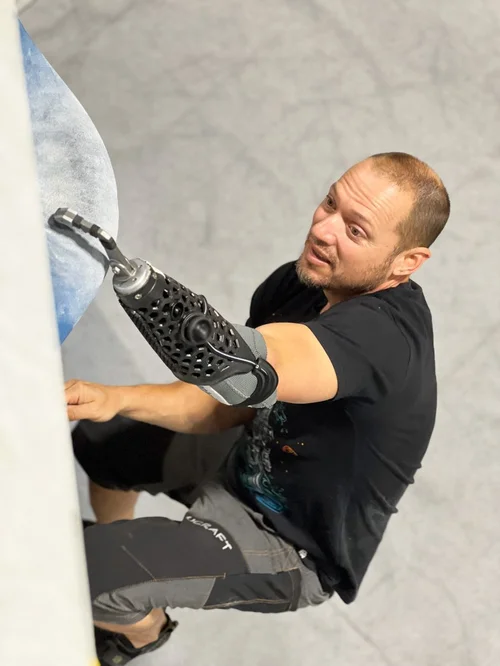 3D PROSTHETICS | Elevate Your Mobility — Quorum Prosthetics