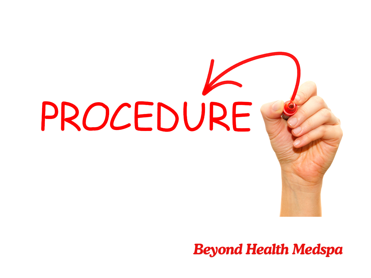 PDO Thread Lift Before and After | Beyond Health Medspa