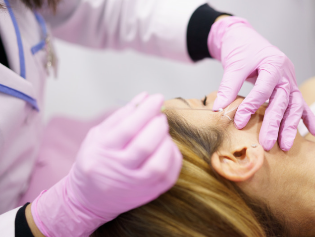 PDO Thread Lift Recovery Time | What to Expect