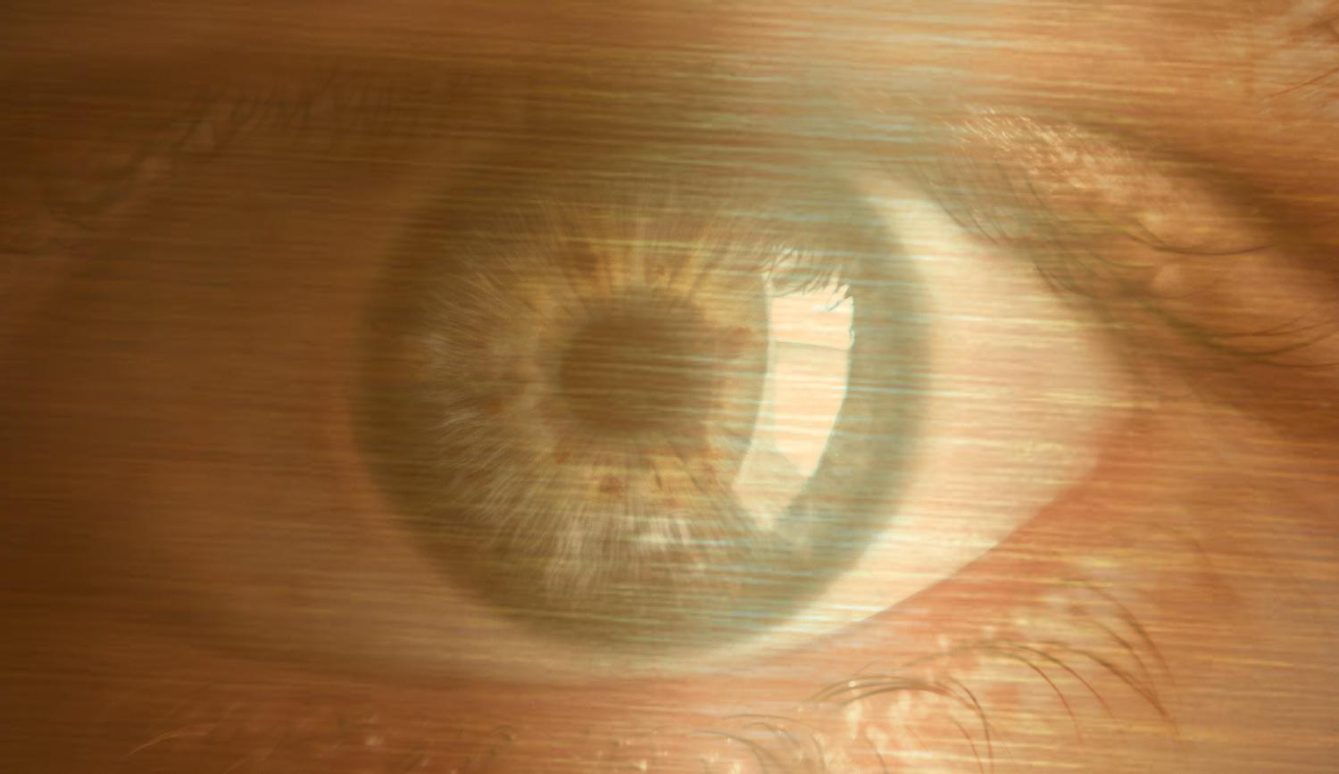 Bronze Eye Examination — Eye Academy