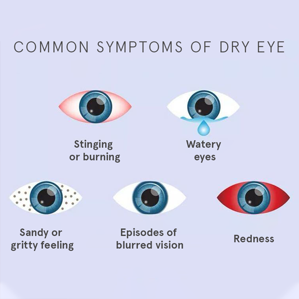 Dry Eye Syndrome — Eye Academy