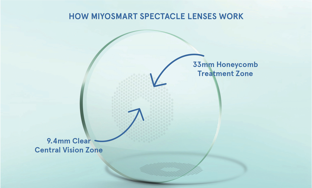 Hoya MiYOSMART Myopia Control Spectacle Lenses — Eye Academy