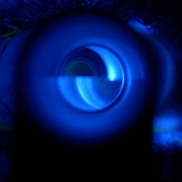Goldmann Applanation Tonometry — Eye Academy