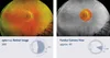 Optomap Scans - Advanced Retina Technology — Eye Academy