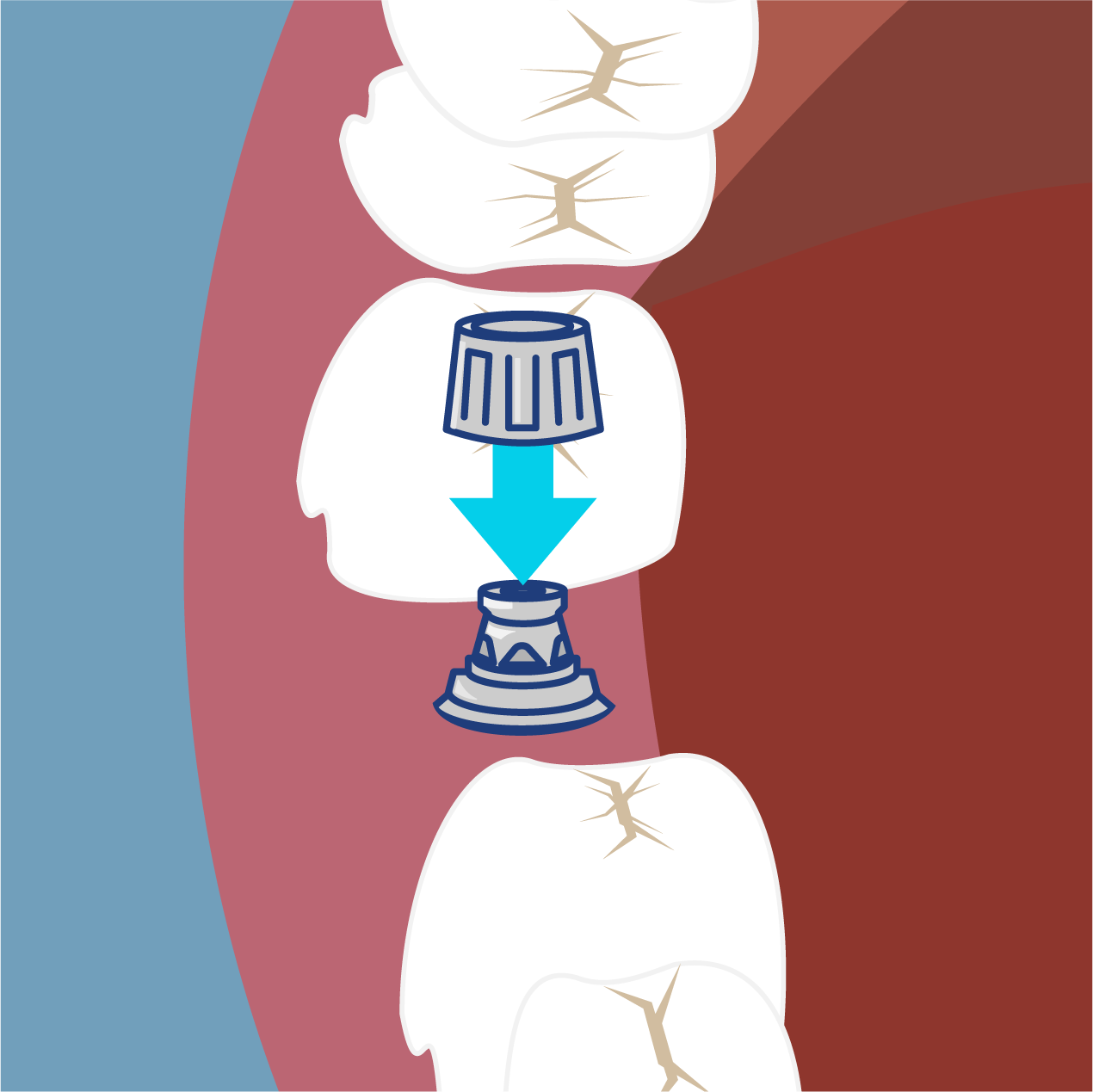 About — RODO Digital Prosthetics Inc.